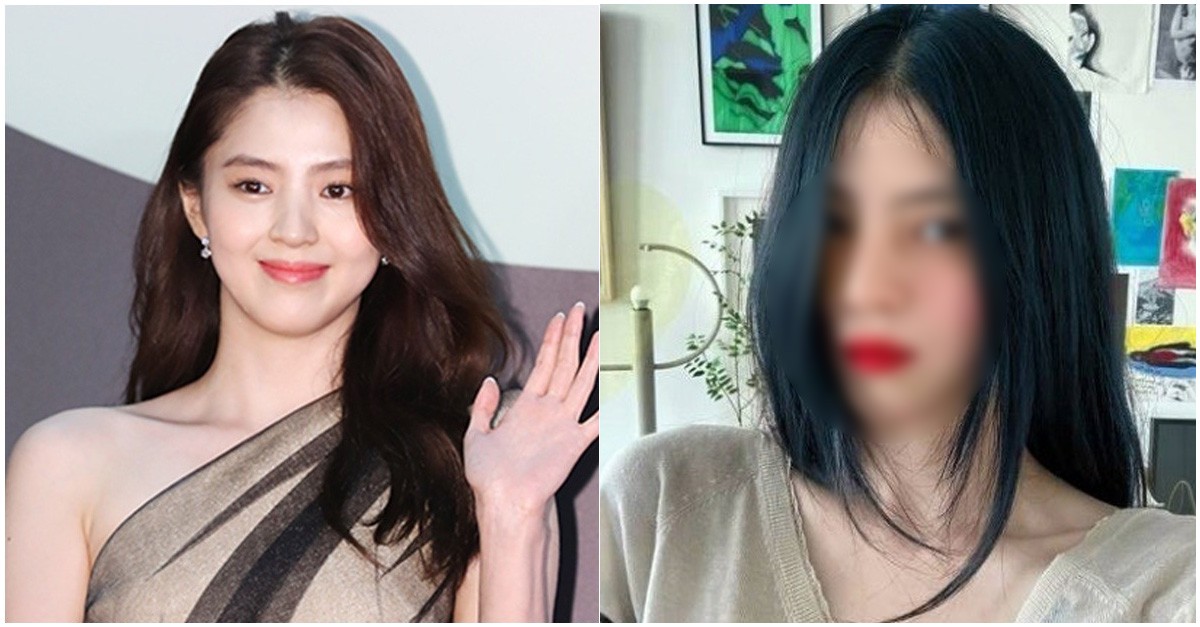 “아직 멍이 ” 안면부상 걱정한 팬들 위해 직접 근황 전한 한소희 Snsfeed 제휴콘텐츠 제공 실시간 핫이슈