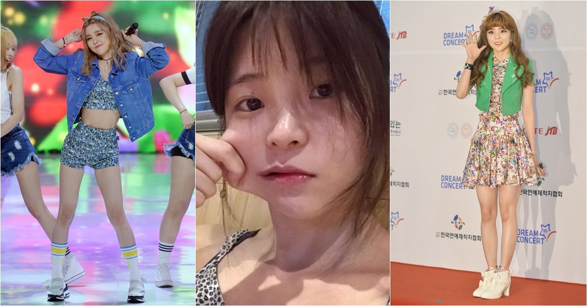 초6 이후 몸무게 30kg 대 유지한다는 여가수 디스패치 뉴스는 팩트다